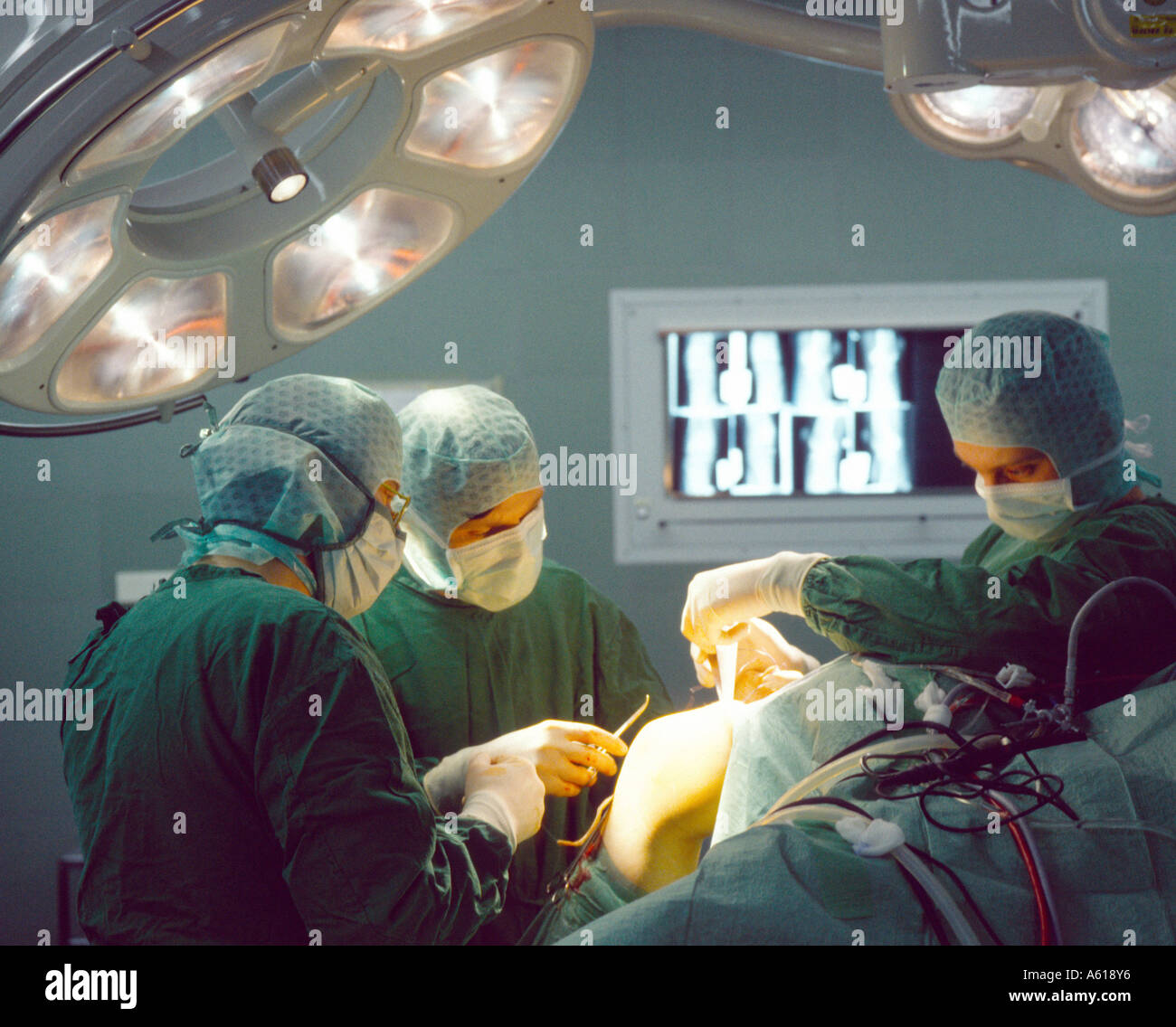 Surgeons operating on patient Stock Photo - Alamy