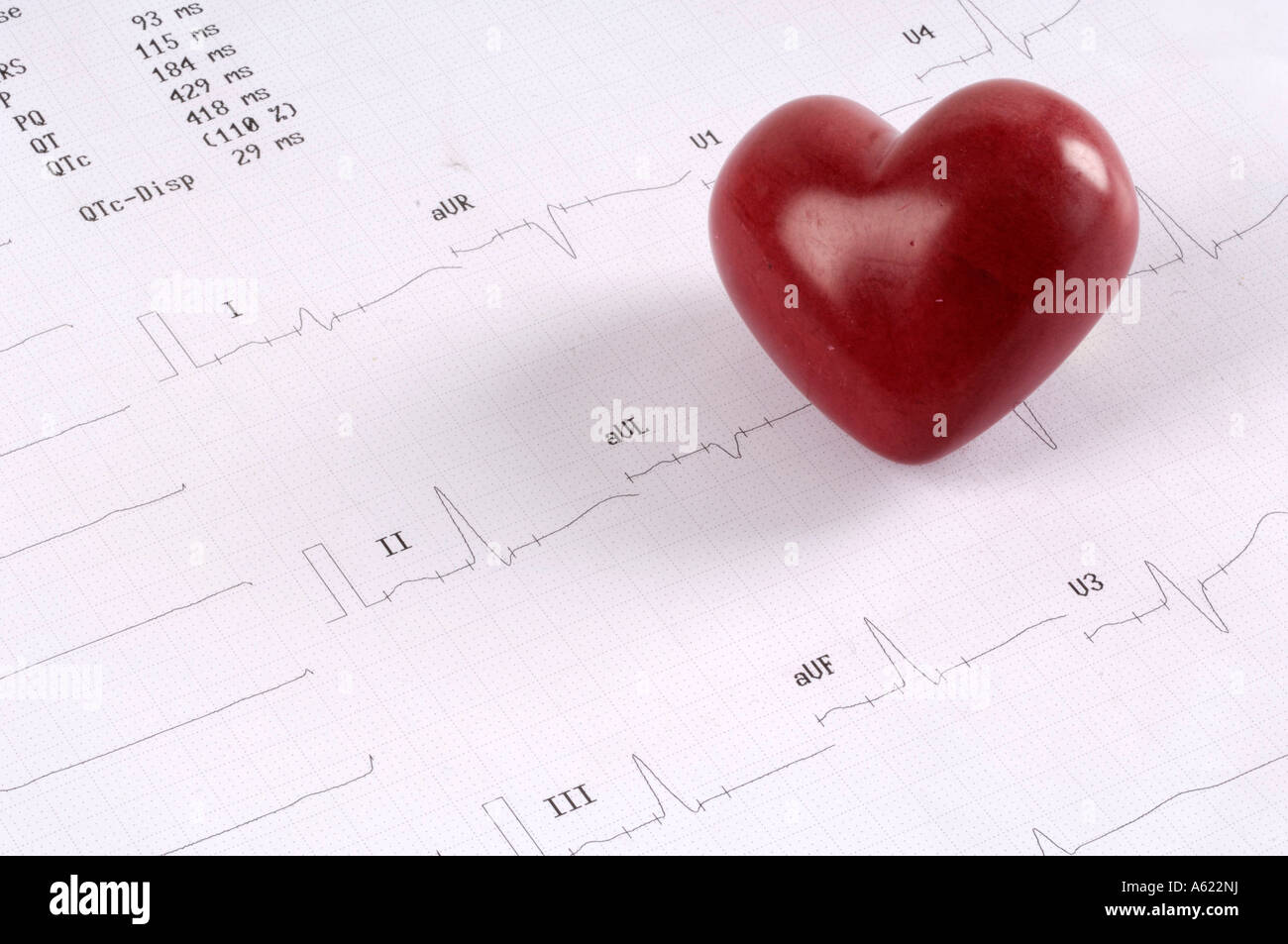 Cardiac curve Stock Photo - Alamy