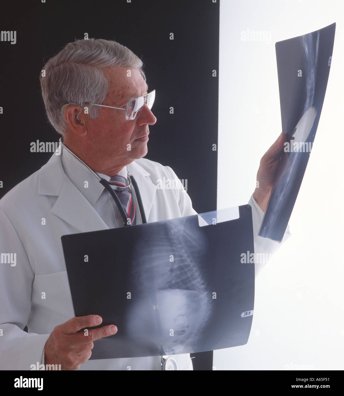 doctor checking x rays Stock Photo - Alamy