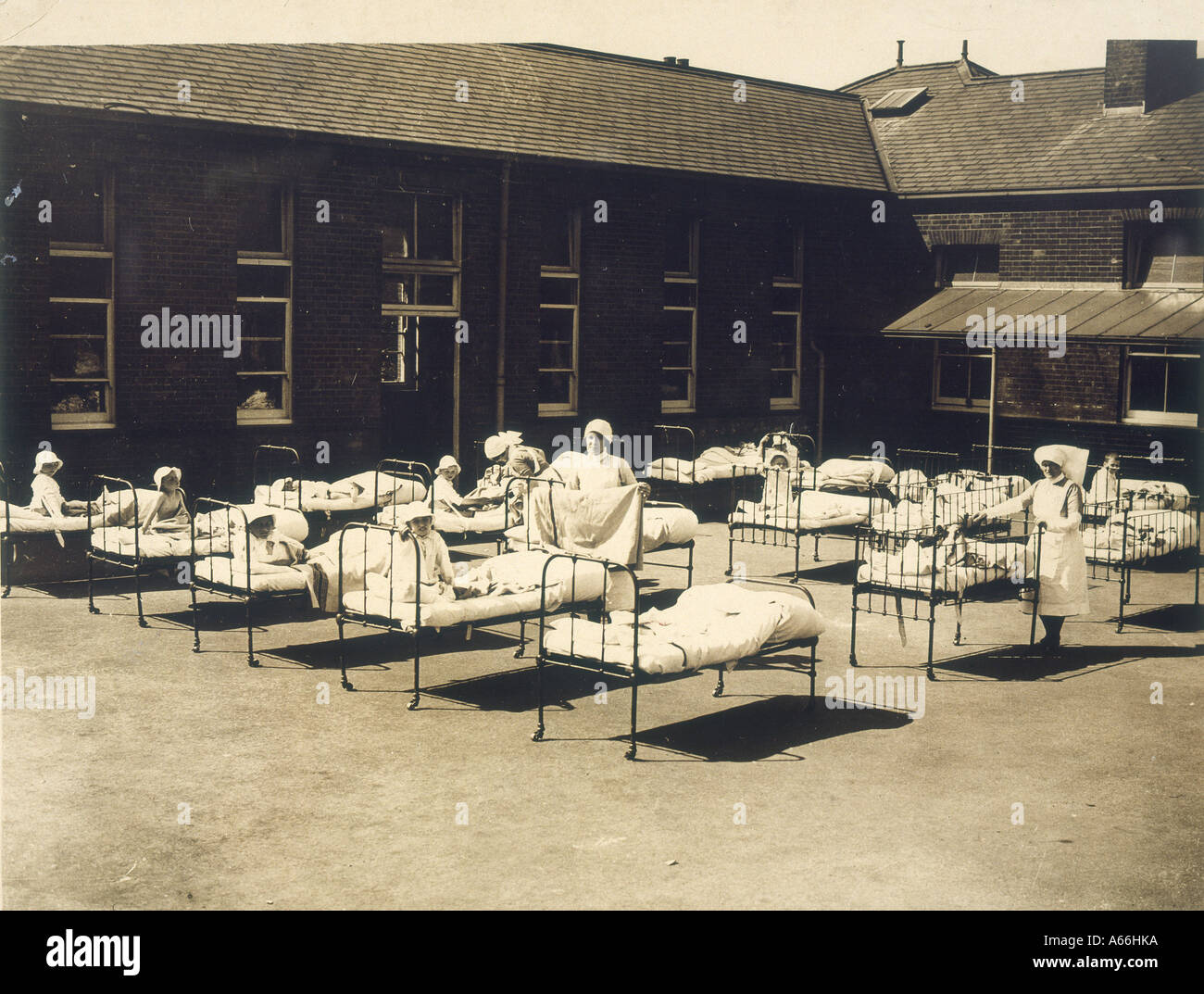 Children With Rickets Stock Photo - Alamy