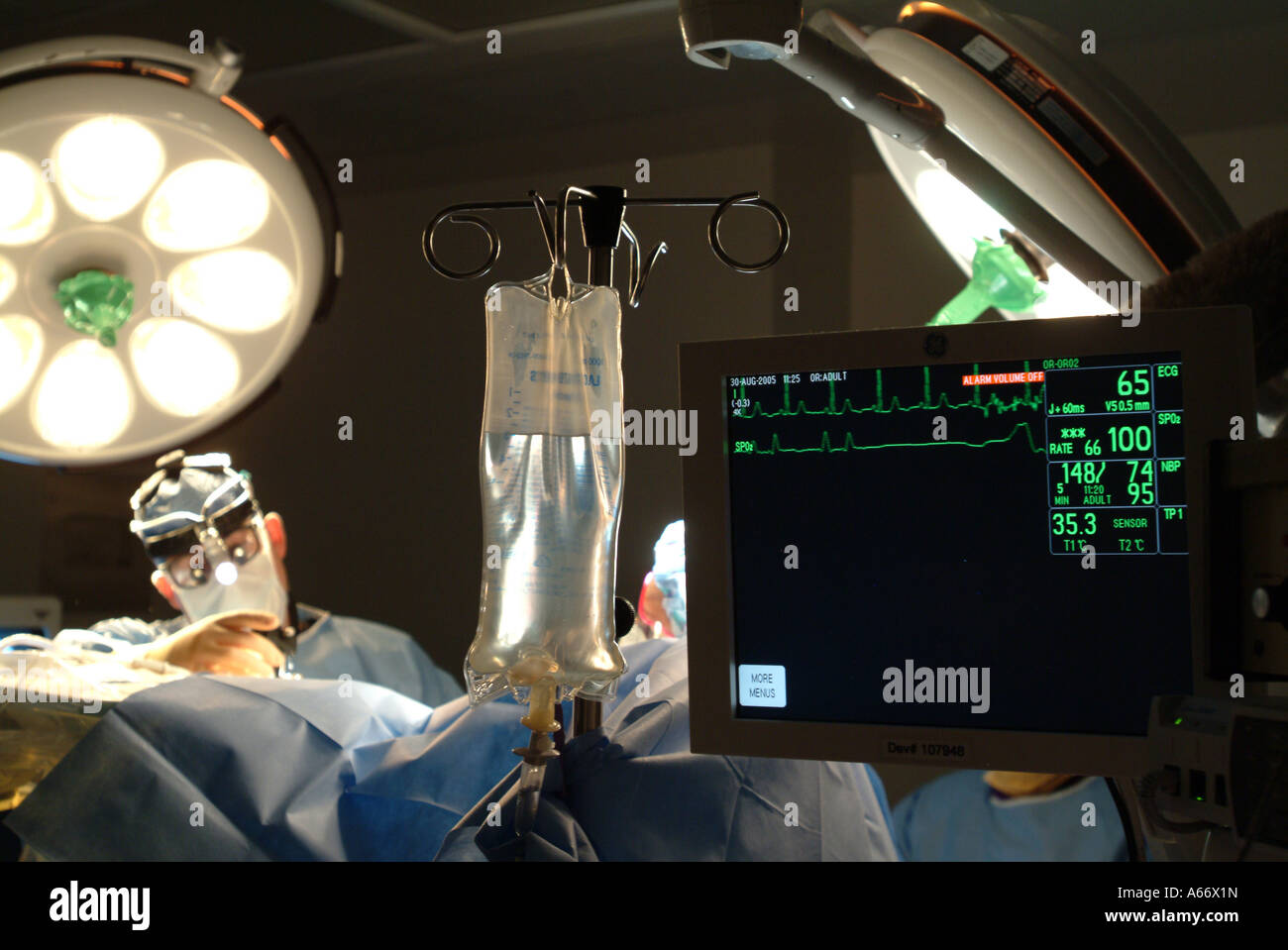 A monitor shows the vital signs of a patient during a brain surgery ...