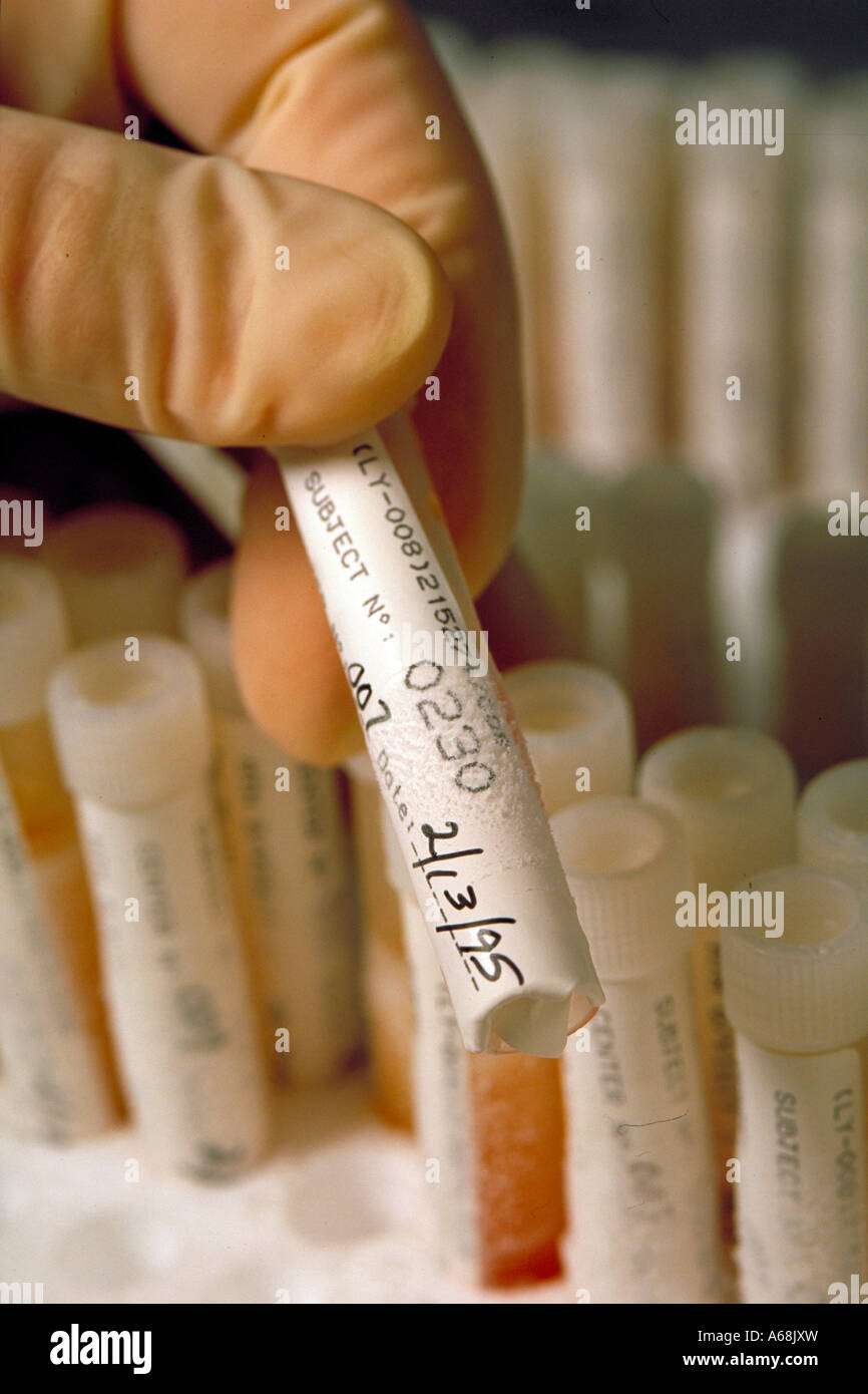 Frozen blood samples used in research study Stock Photo - Alamy