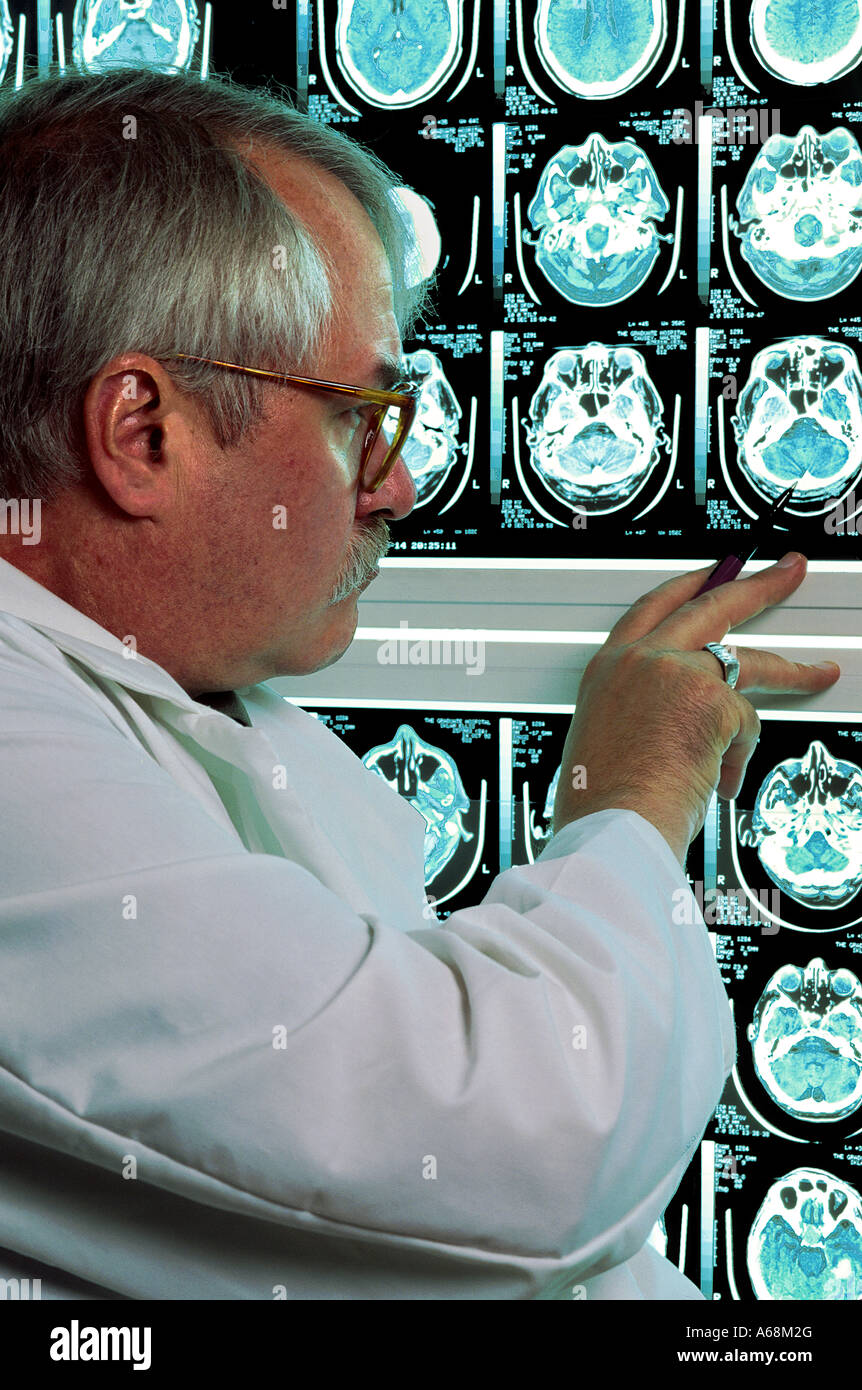 Radiologist reviewing CAT scans MRI Stock Photo - Alamy