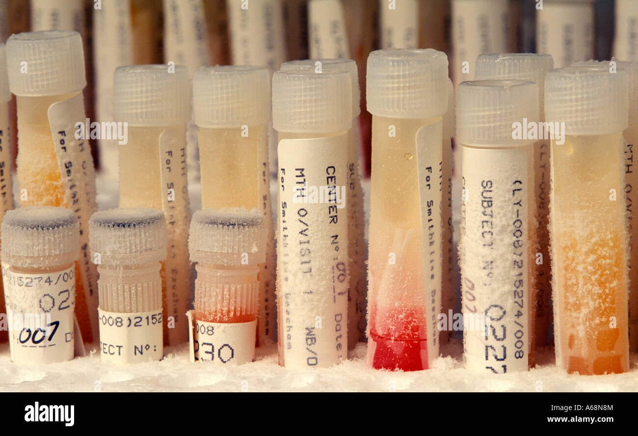 Frozen blood samples used in research study Stock Photo - Alamy