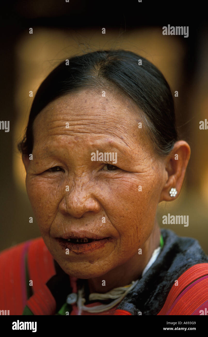 A Lisu woman with lips stained red from chewing betel nuts a mild ...
