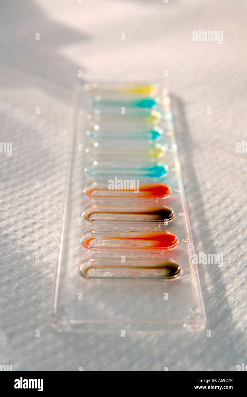 Blood type testing test hi-res stock photography and images - Alamy