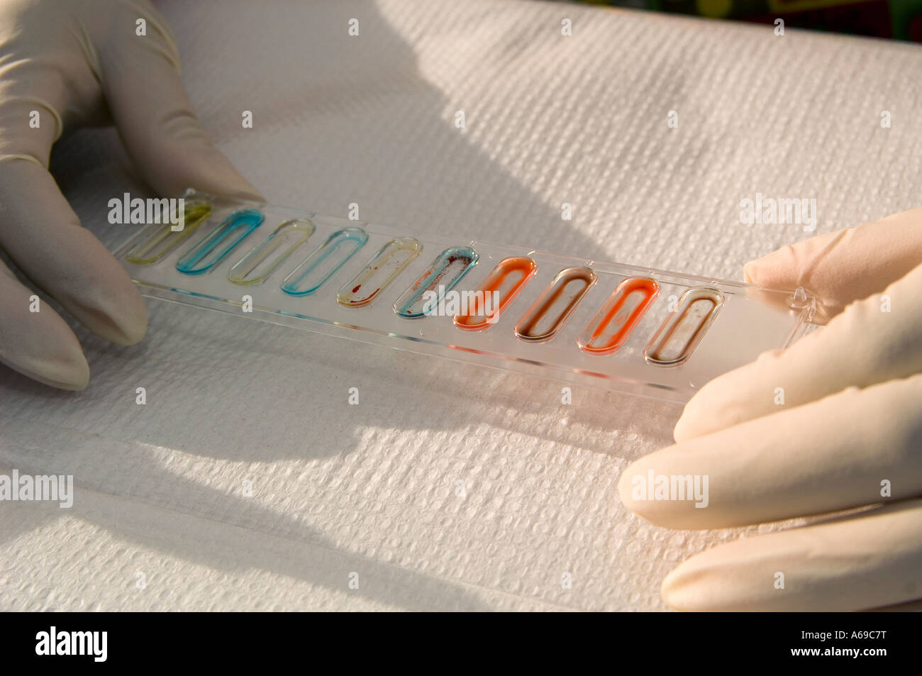 Lab technician doing blood type experiment Stock Photo - Alamy