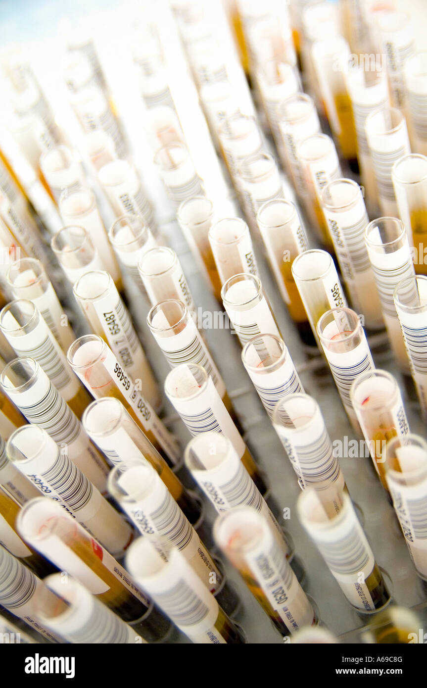 Blood samples in lab clinic Stock Photo - Alamy