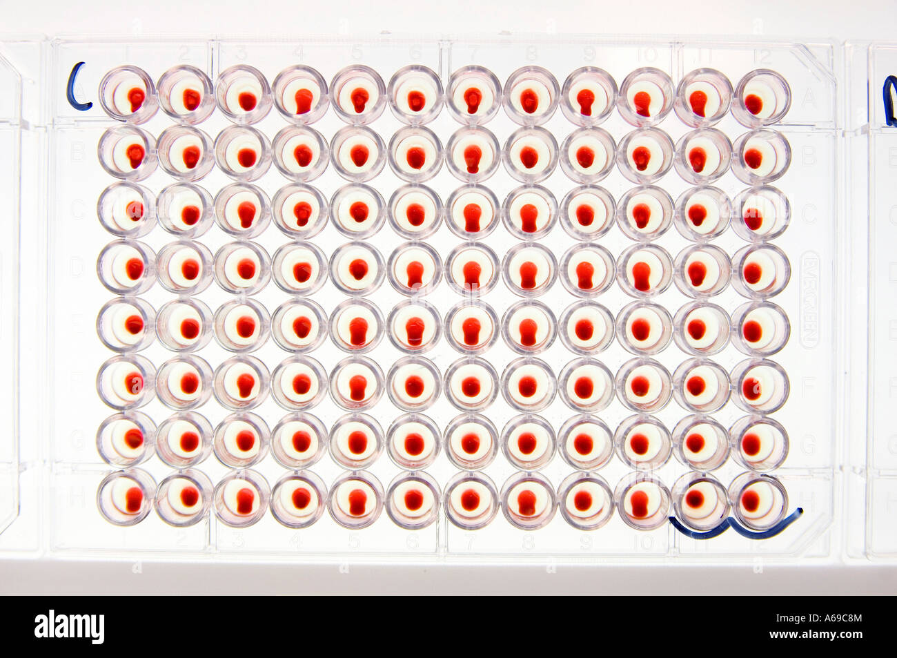 Blood samples in lab clinic Stock Photo - Alamy