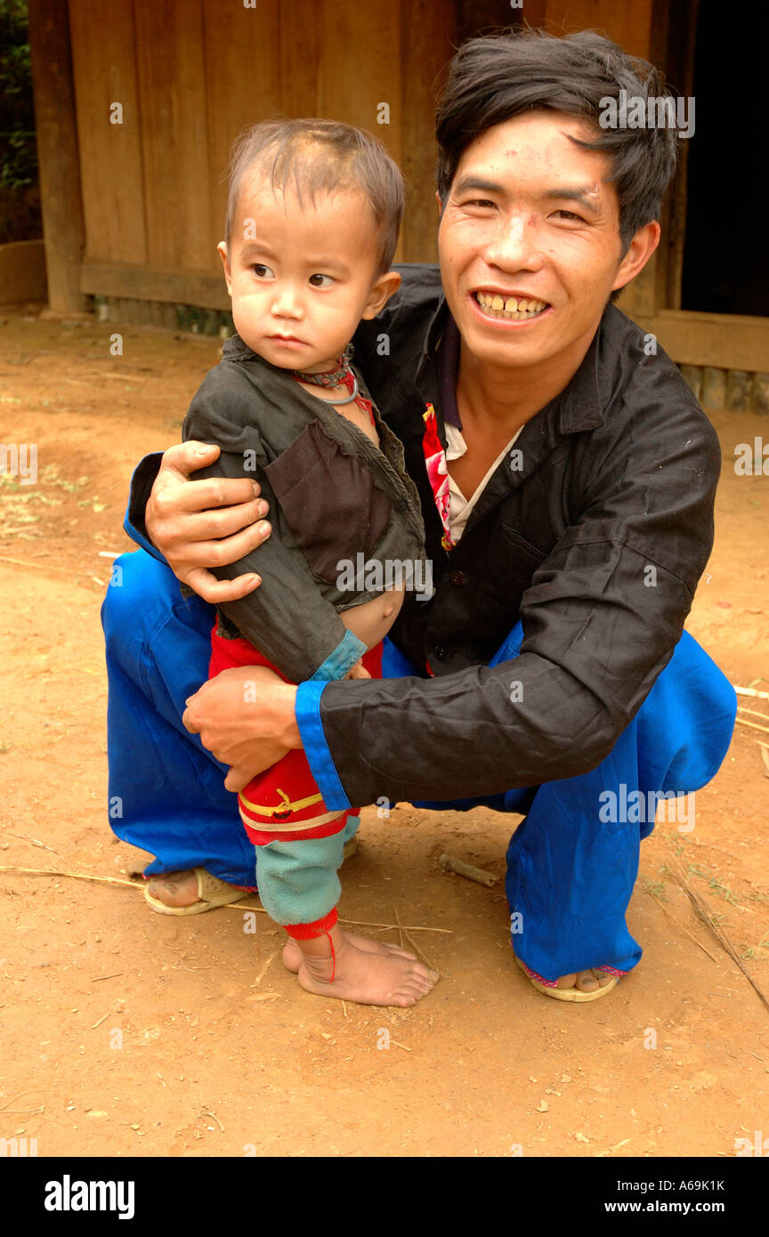 A Blue Hmong indigenous man wearing traditional cloth hugs his son in ...