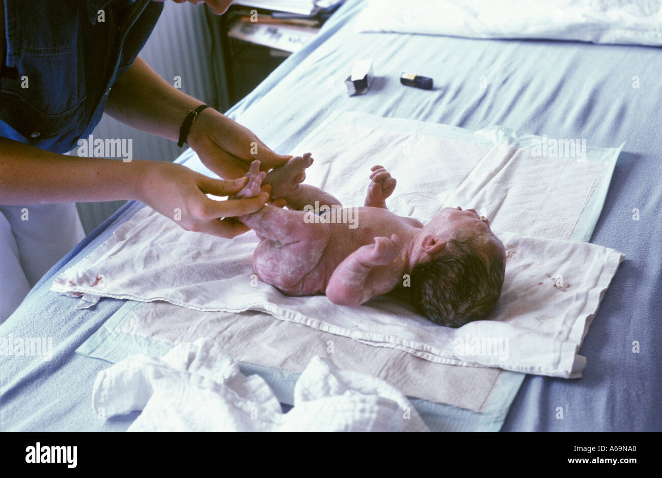 Newborn apgar score hi-res stock photography and images - Alamy