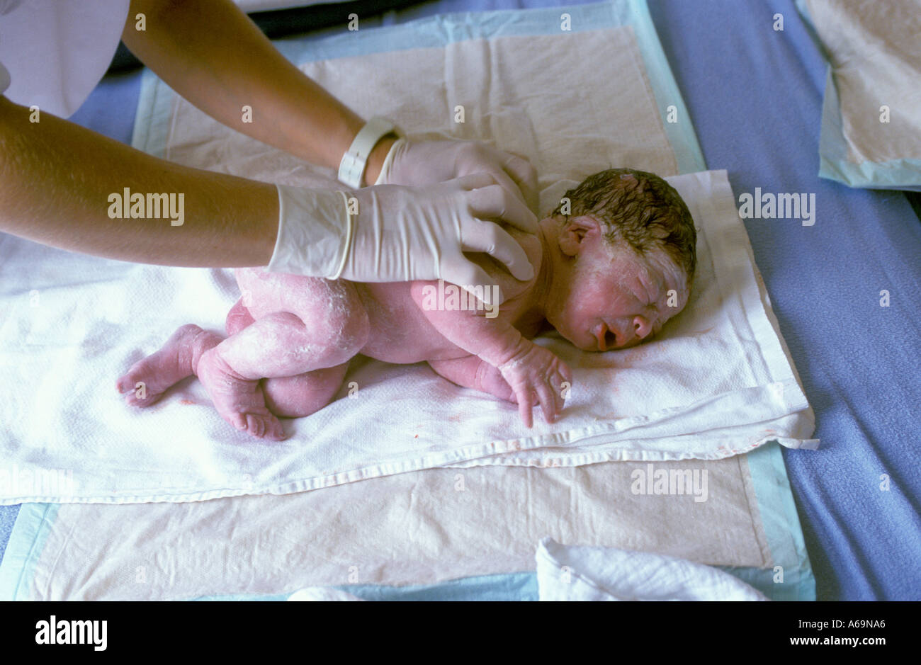 Apgar hi-res stock photography and images - Alamy