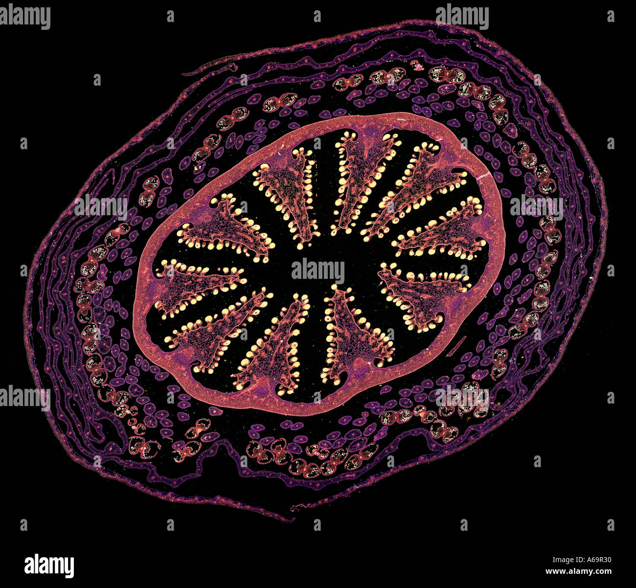Poppy flower head section photomicrograph black background Stock Photo ...