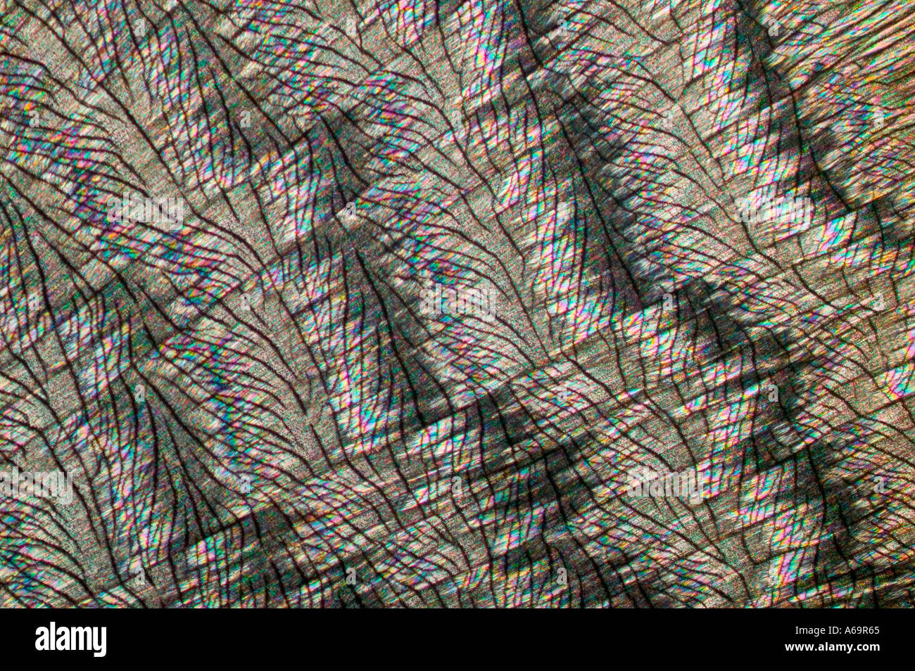 Hippuric acid crystals hi-res stock photography and images - Alamy