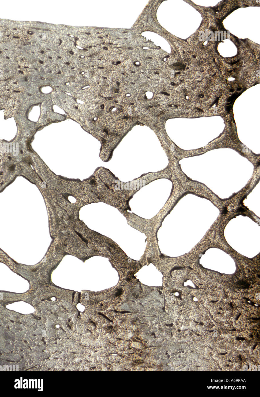 Human scapula bone section photomicrograph white background Stock Photo ...