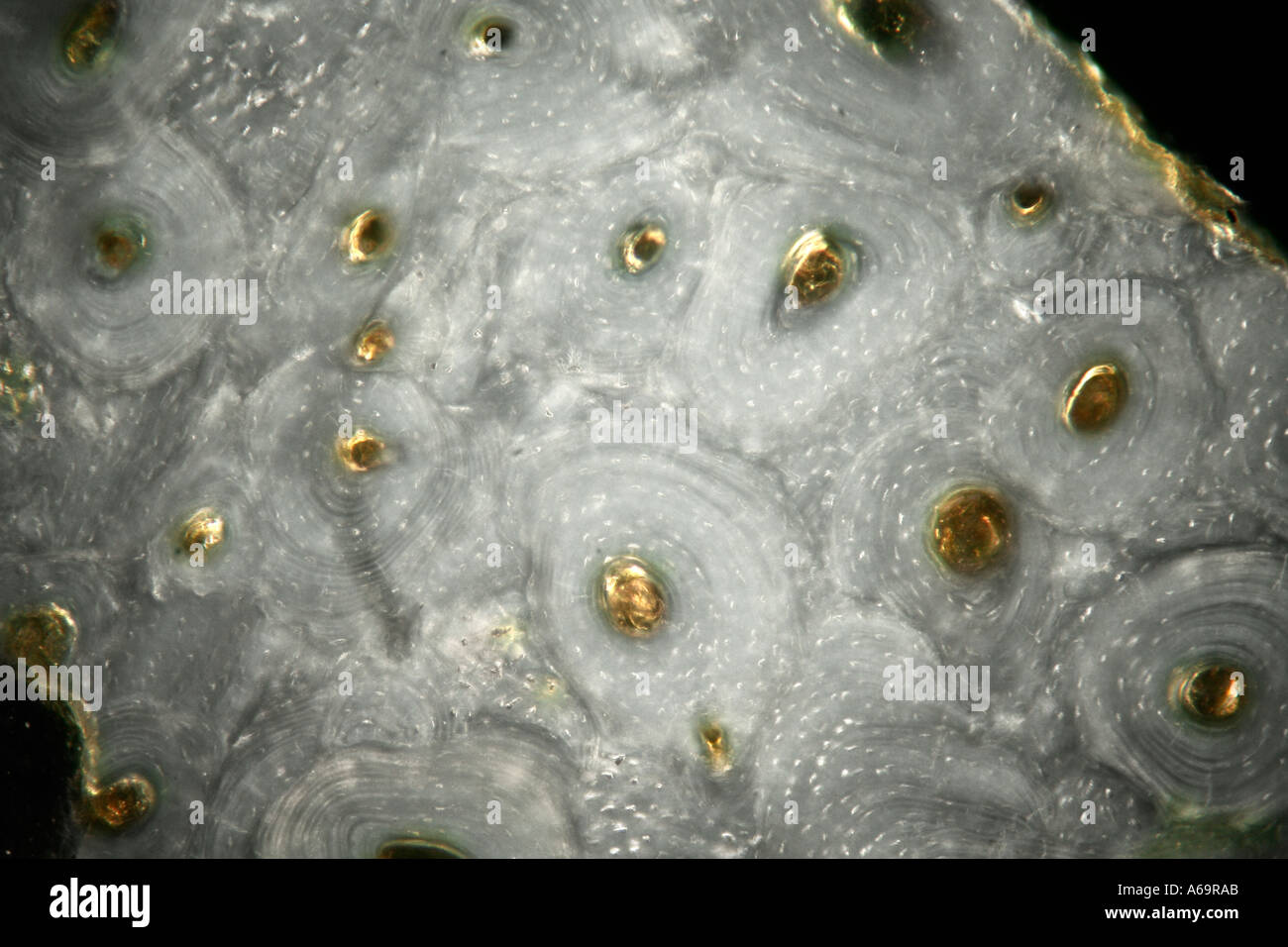 Microscope anatomy calcium skeletal human bone section photomicrograph ...