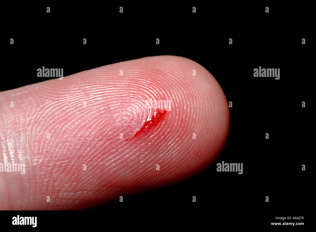 Person with cut finger with blood pouring out of the wound Stock Photo ...
