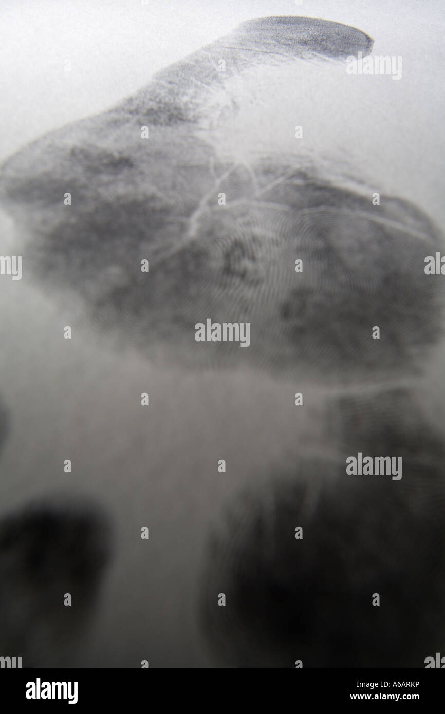 Bear toes hi-res stock photography and images - Alamy