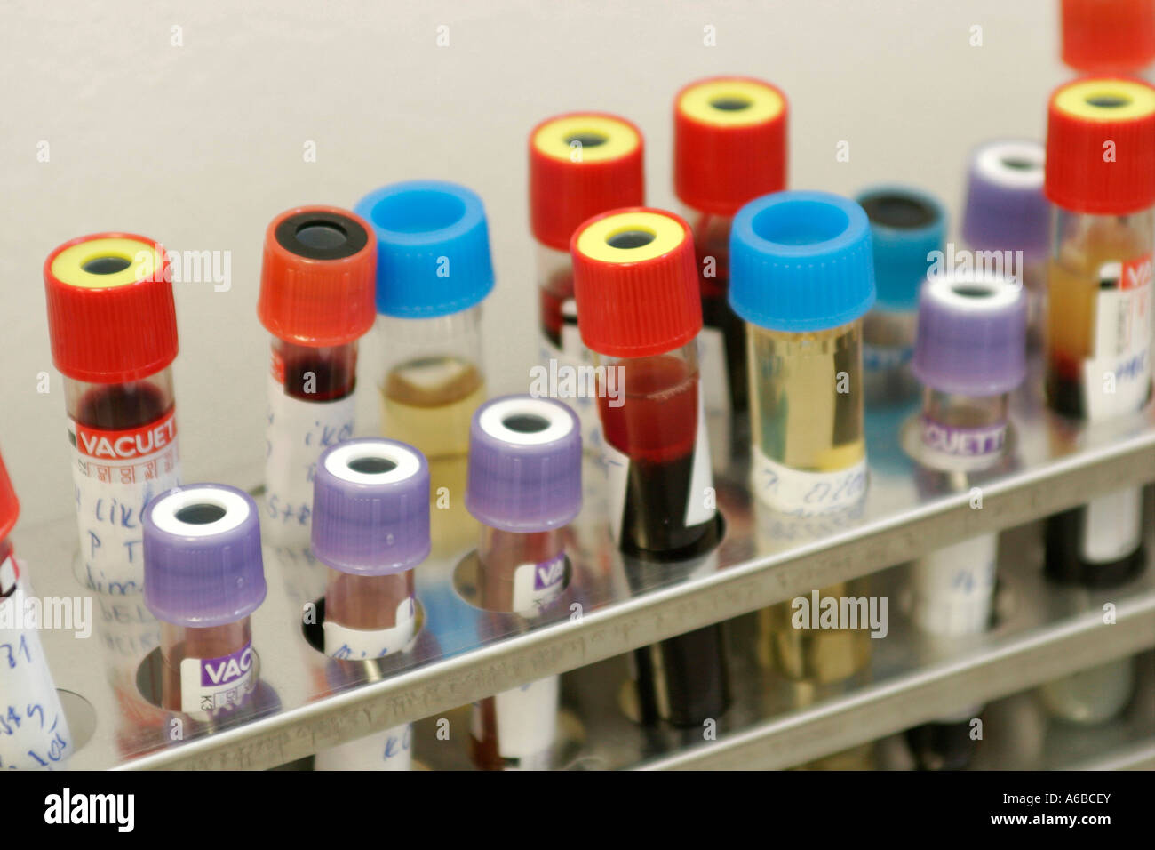 Test tubes with Blood and Urine Stock Photo - Alamy