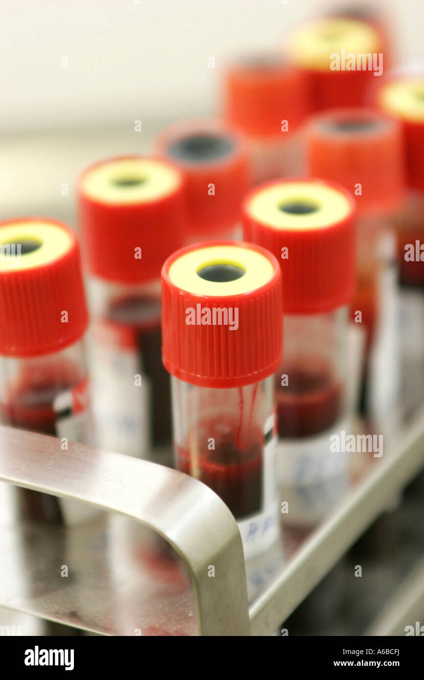 Test tubes with Blood Stock Photo - Alamy