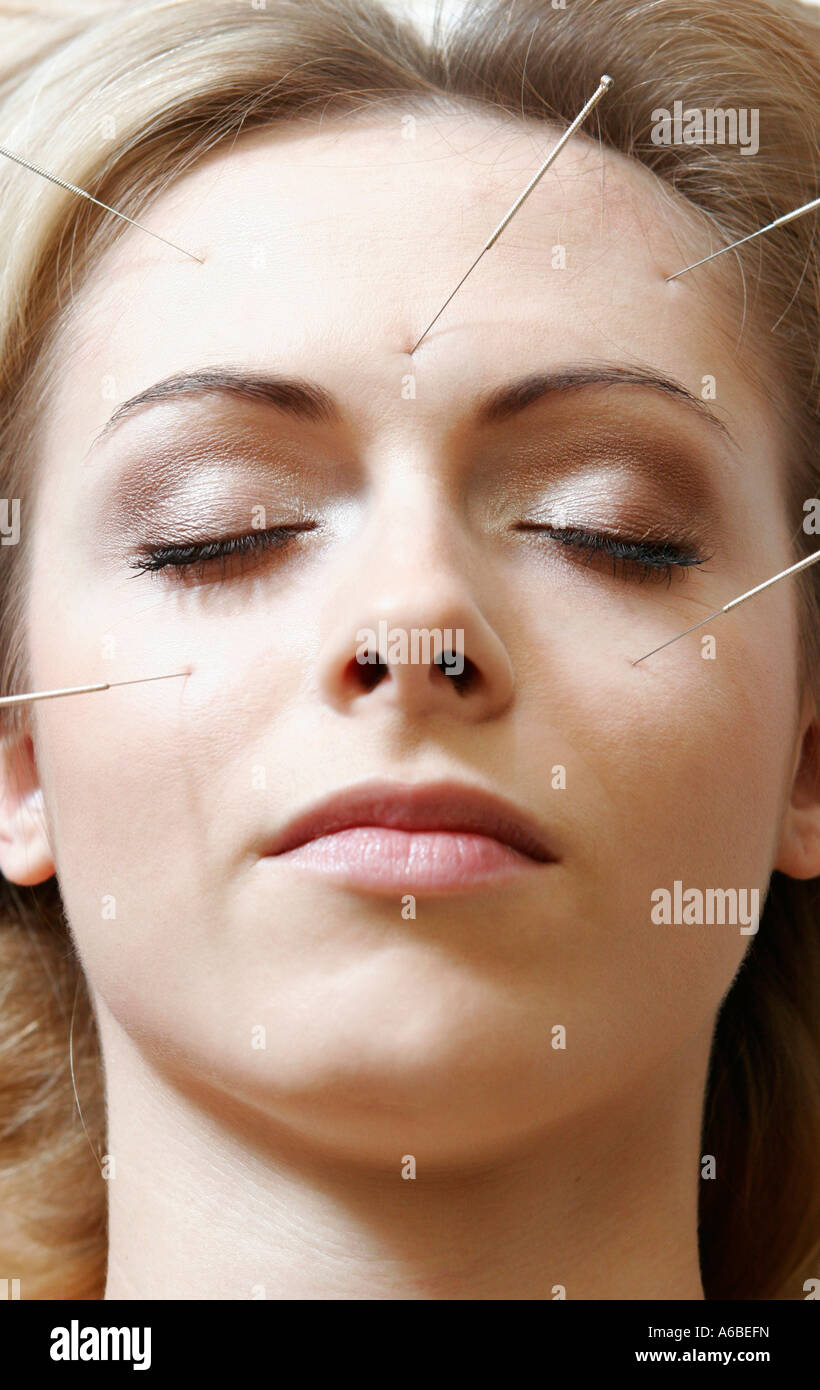 Accupuncture treatment hi-res stock photography and images - Alamy