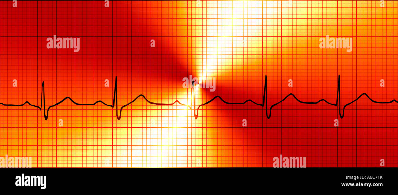 EKG electro cardiogram closeup view Stock Photo - Alamy