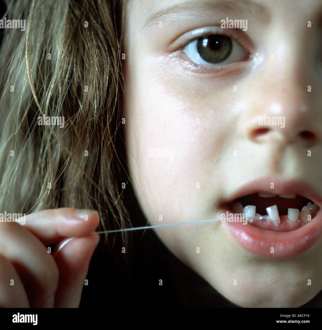 Tooth loose hi-res stock photography and images - Alamy