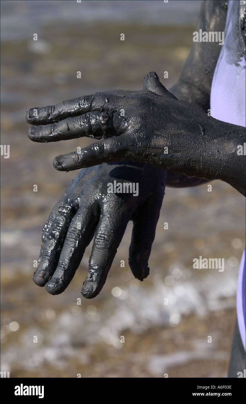 Mud bath the Dead Sea Jordan Stock Photo - Alamy