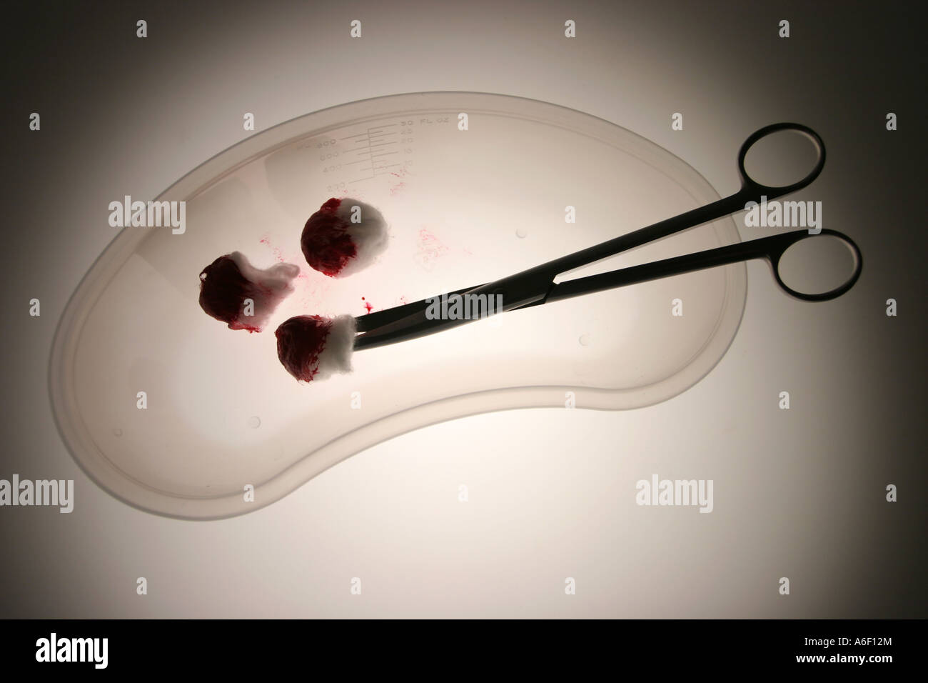 Medical Scissors and blood stained cotton balls Stock Photo - Alamy