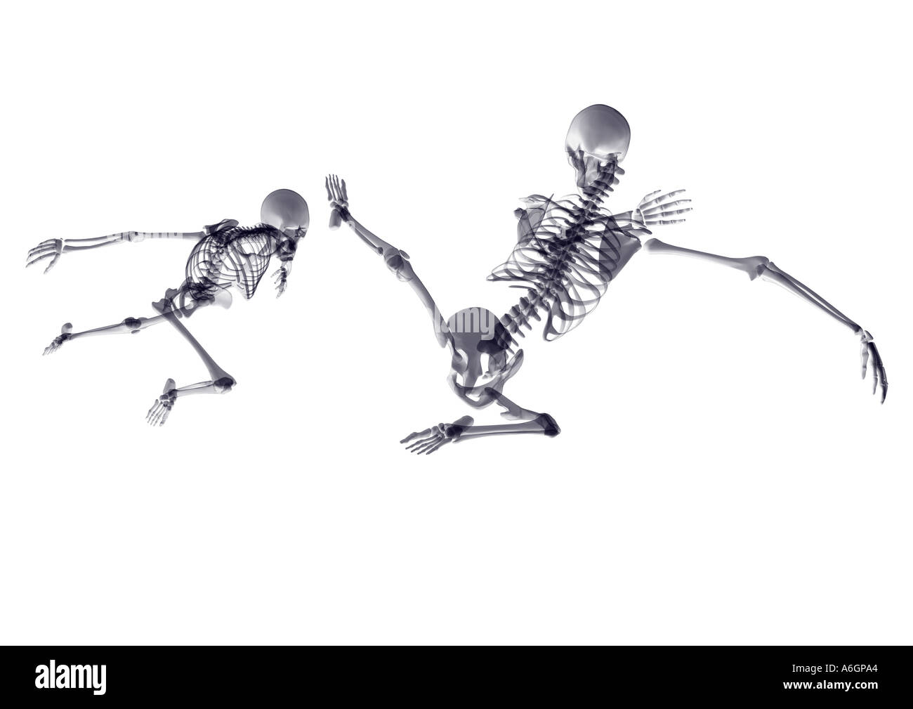 Skeleton x ray xray bizarre hi-res stock photography and images - Alamy
