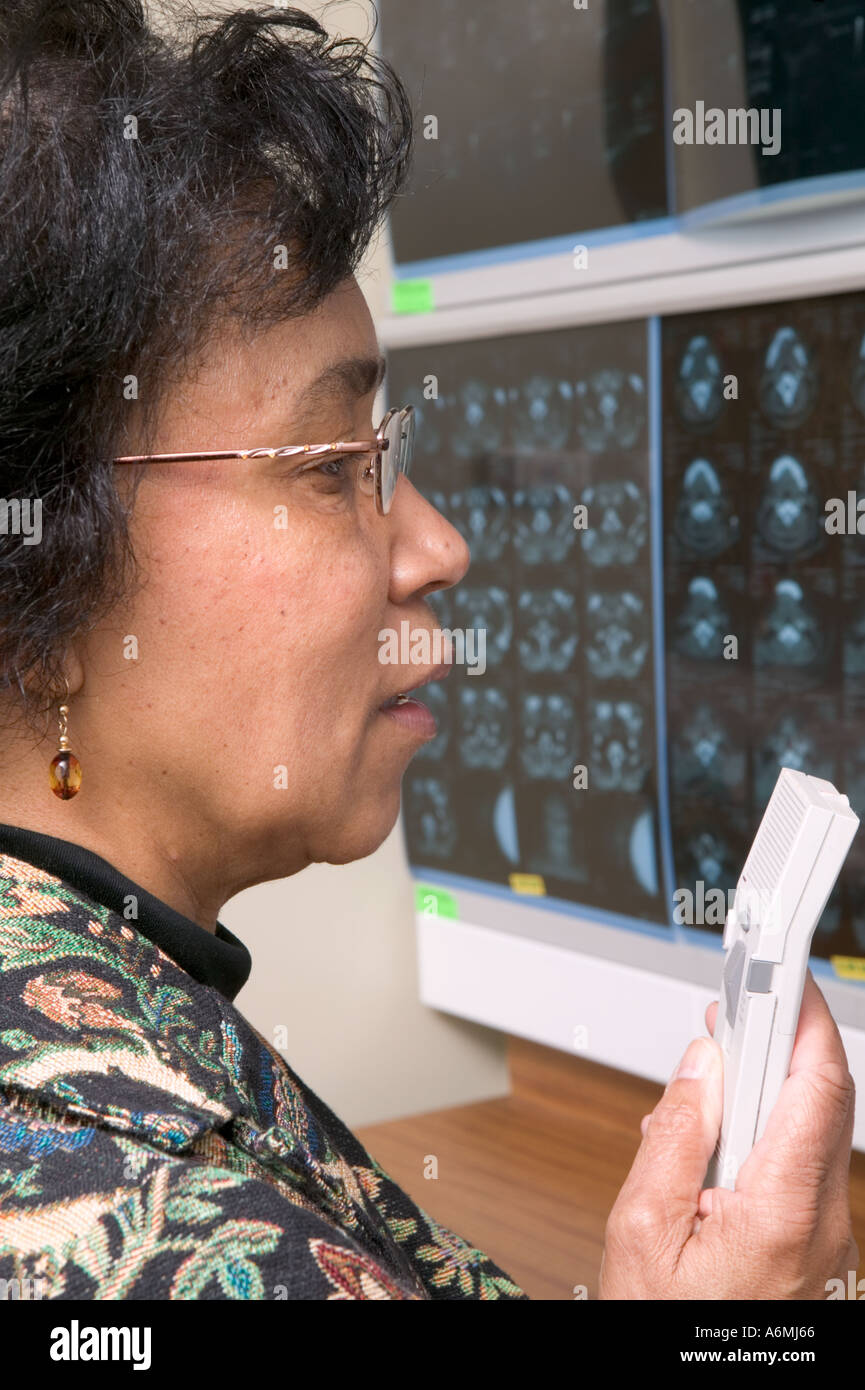 Female radiologist evaluates CAT scan CT films on a light box recording ...