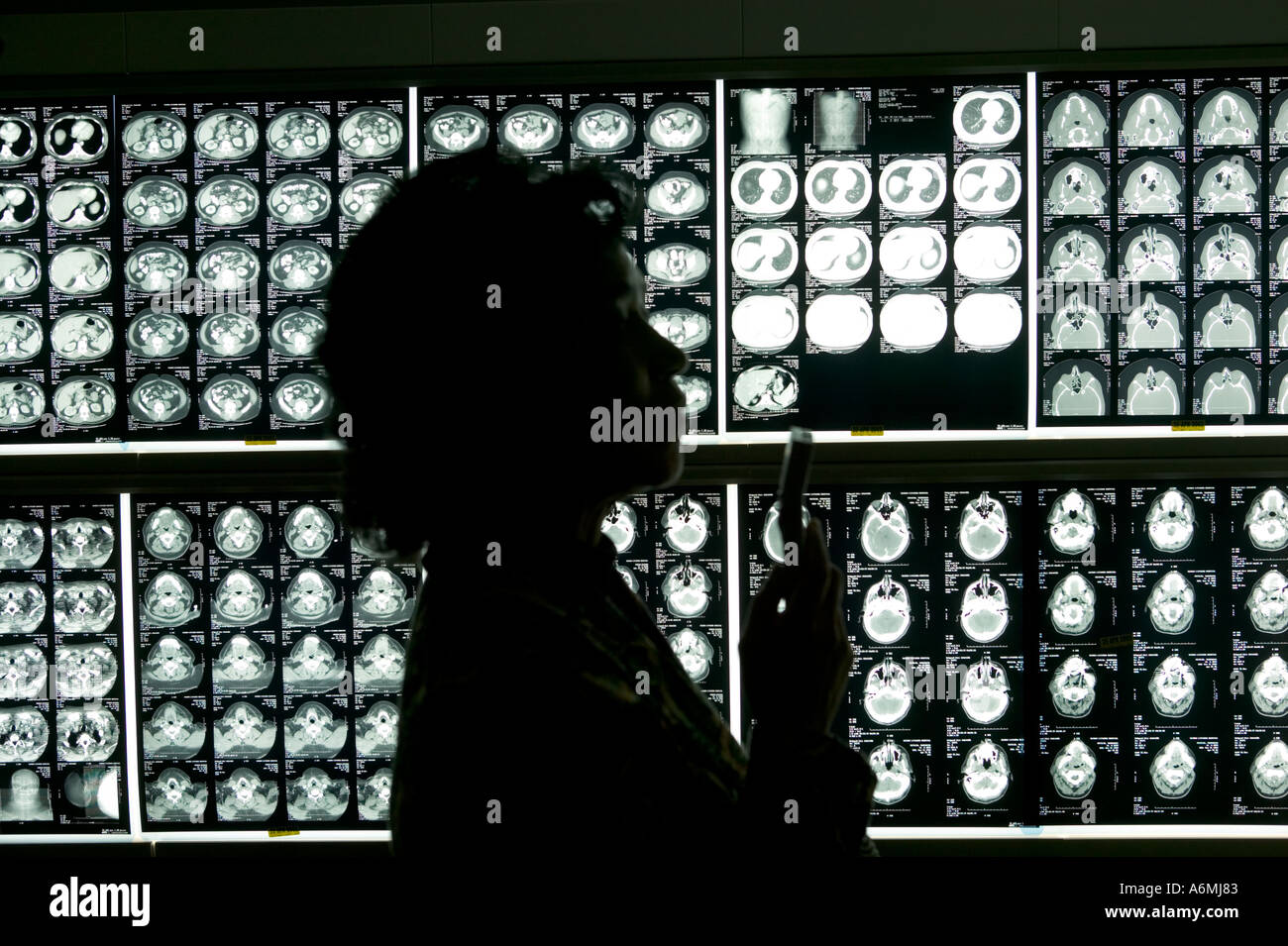 Female radiologist evaluates CAT scan CT films on a light box recording ...