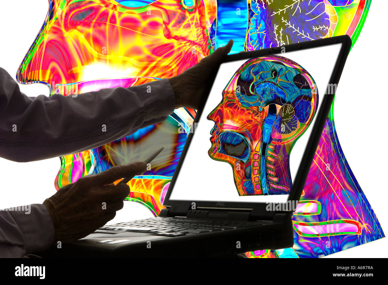 image of color coded human skull on monitor and background screen with ...