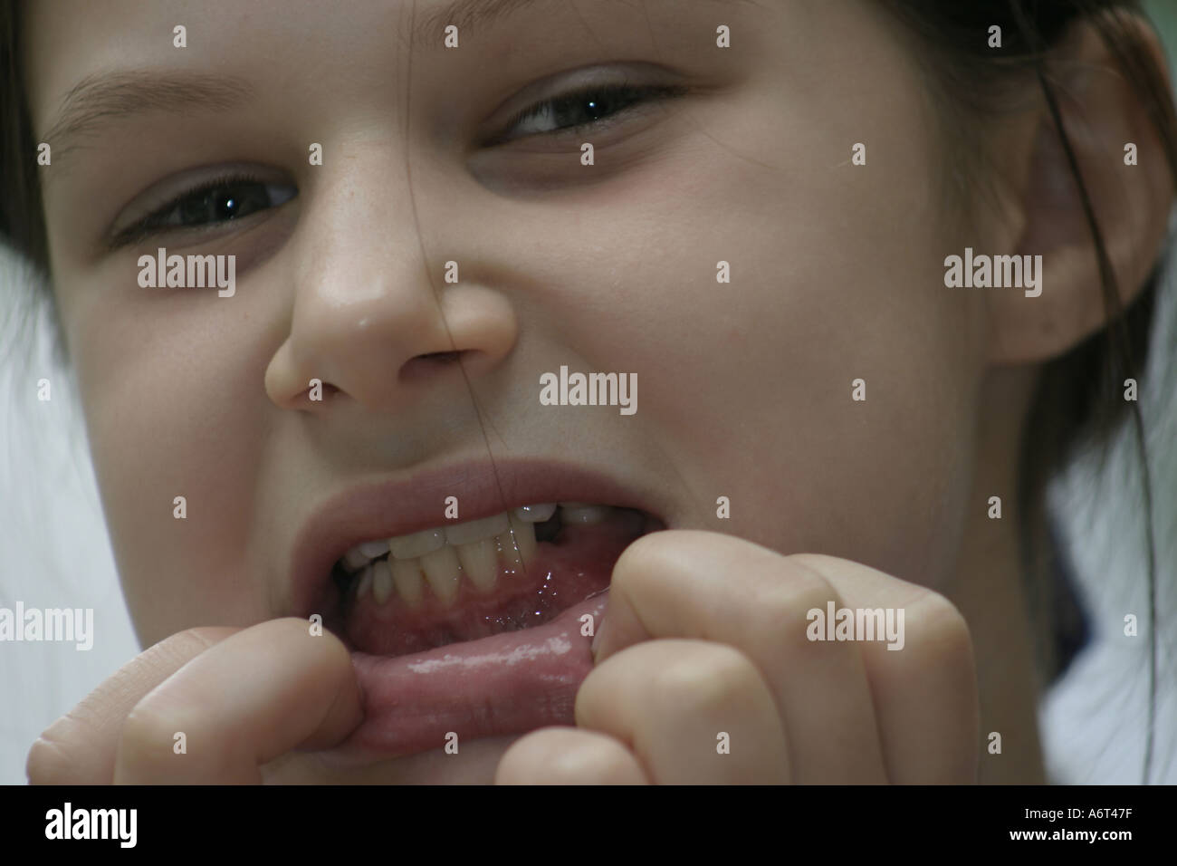 Young girl aged eleven shows her missing tooth Stock Photo - Alamy