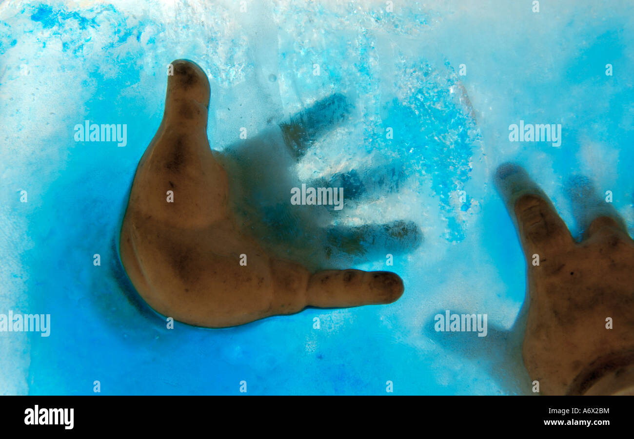 Amputated hands hi-res stock photography and images - Alamy