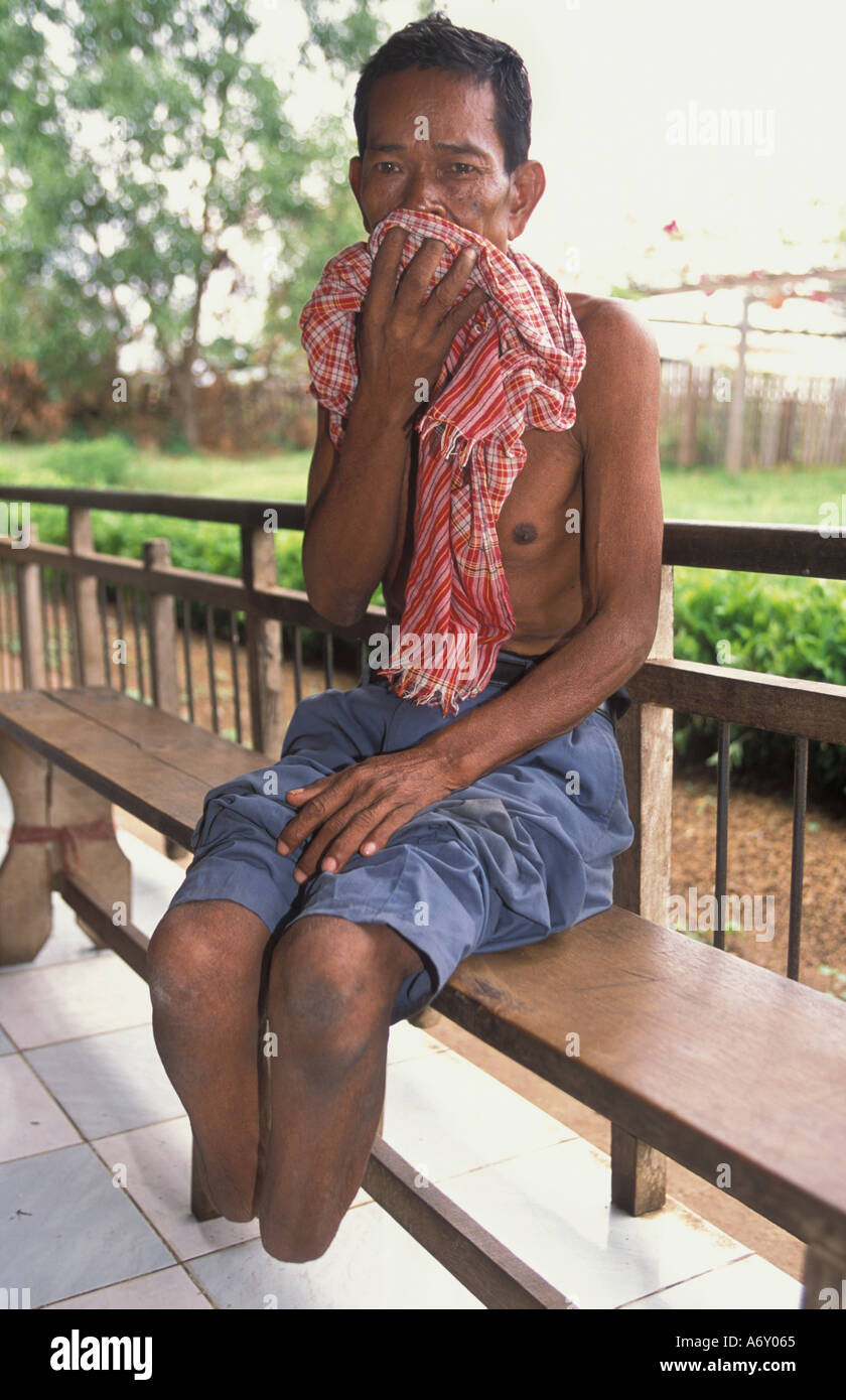 Cambodia legless Land mine victim waits at hospital in Preah Vittear ...