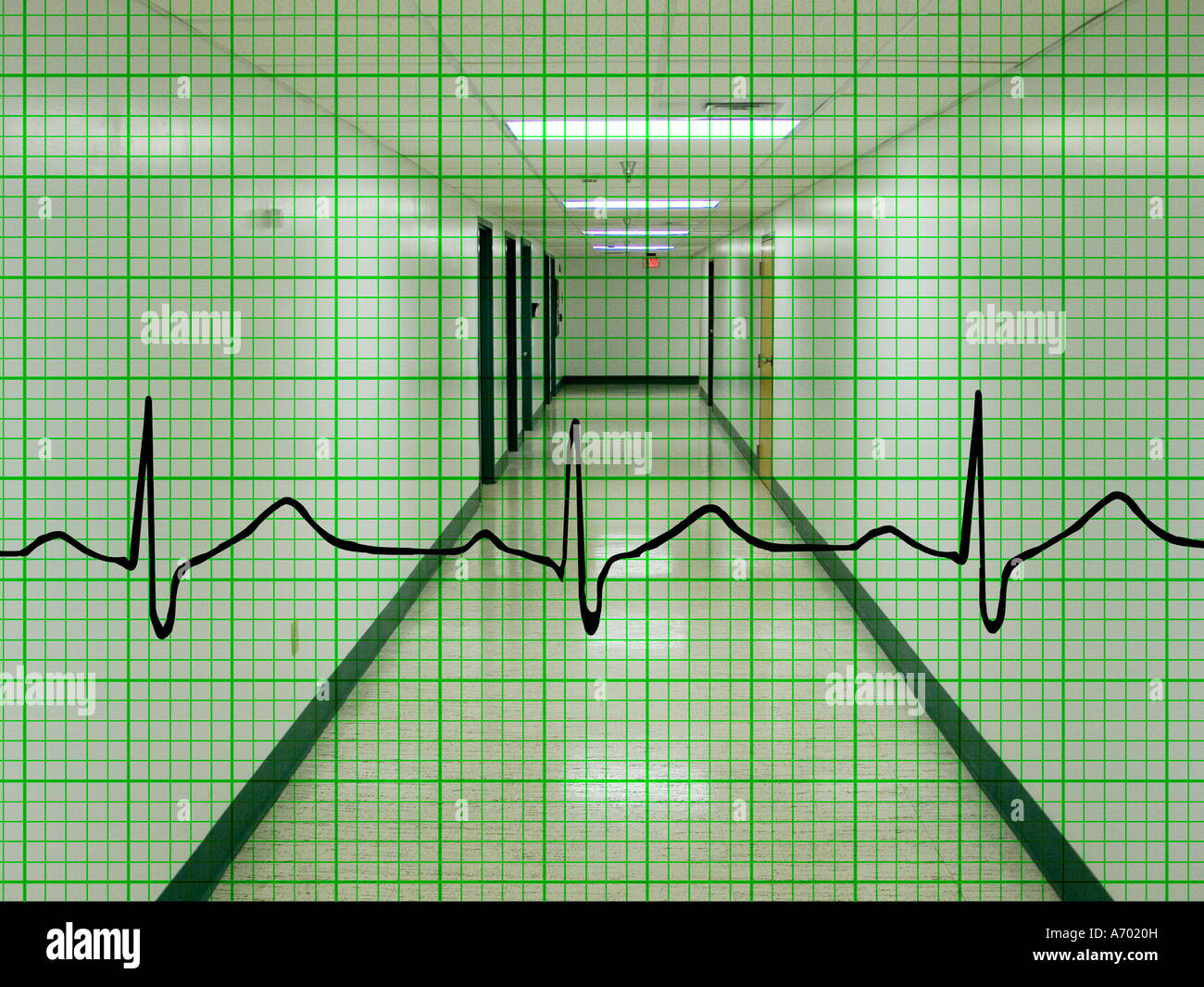 EKG electro cardiogram composited over hospital corridor Stock Photo ...