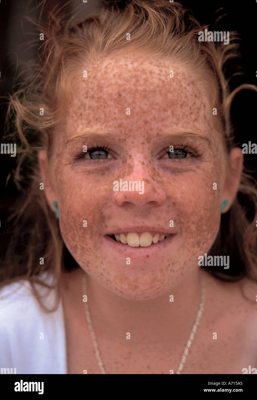 Young Australian Christian girl with freckles, 1980s Stock Photo - Alamy