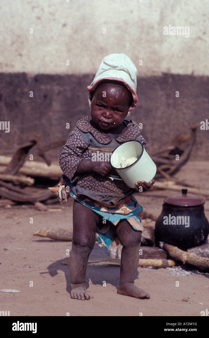 African baby with tin cup in Zimbabwe refugee camp Stock Photo - Alamy