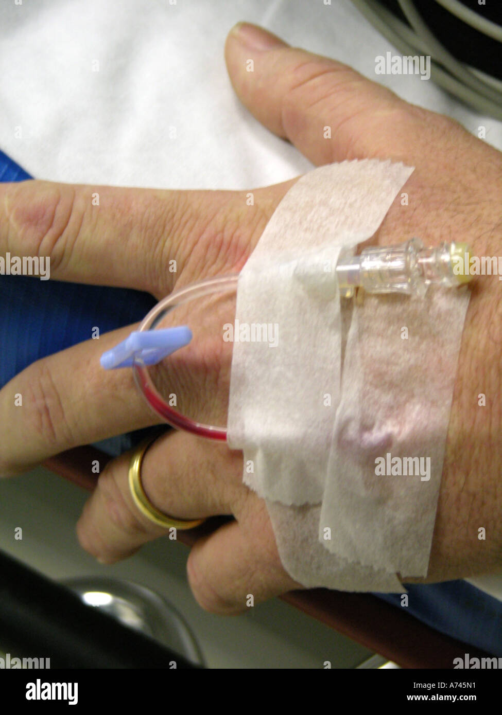 IV drip tube in hand Stock Photo - Alamy