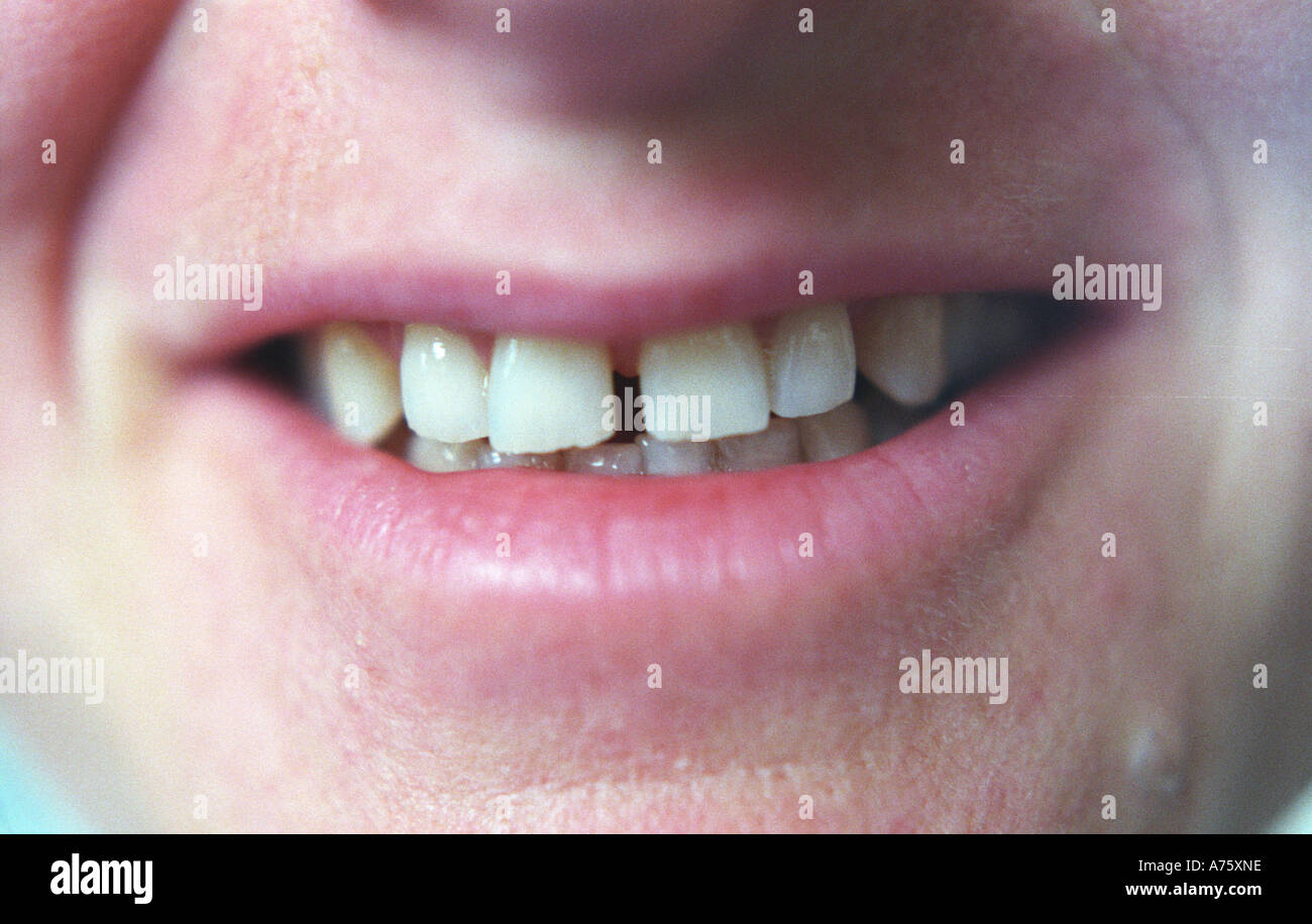 Close up mouth lips parted hi-res stock photography and images - Alamy