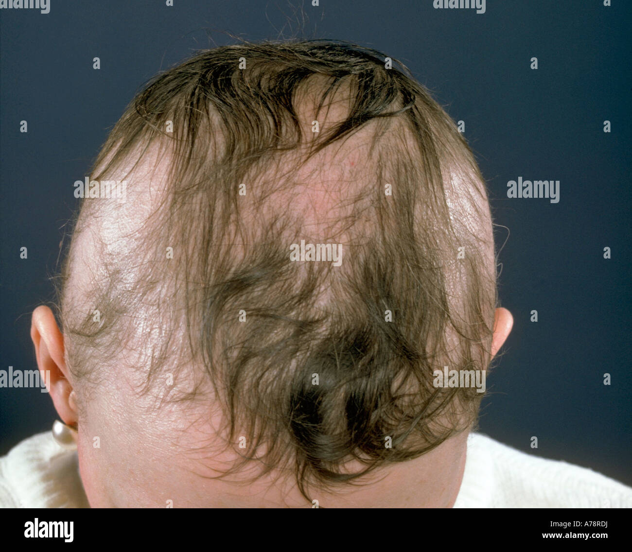 Alopecic hi-res stock photography and images - Alamy