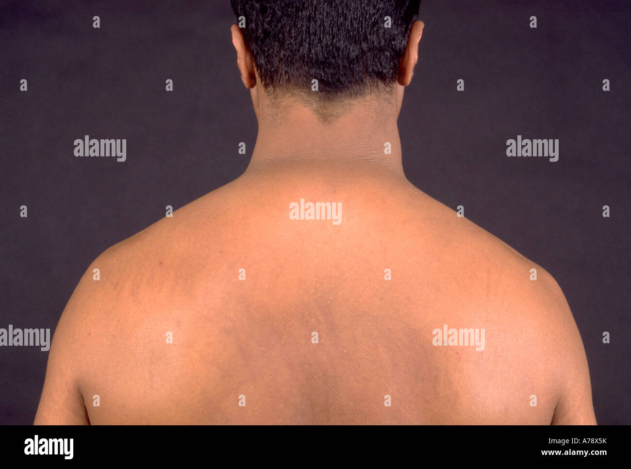 Antiretroviral drugs hiv hi-res stock photography and images - Alamy