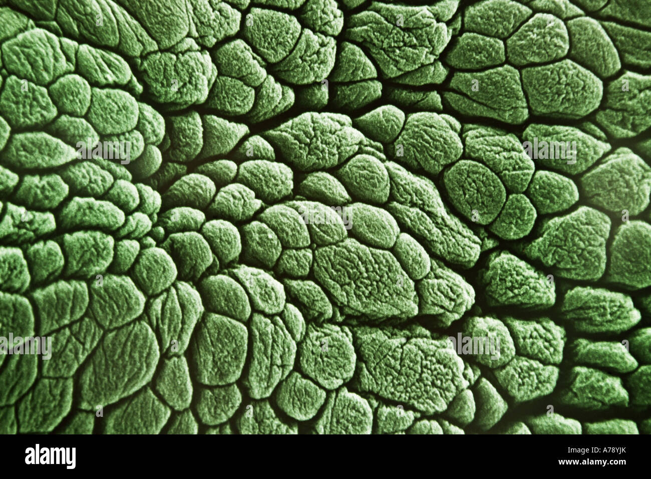 Surface of bladder Stock Photo - Alamy