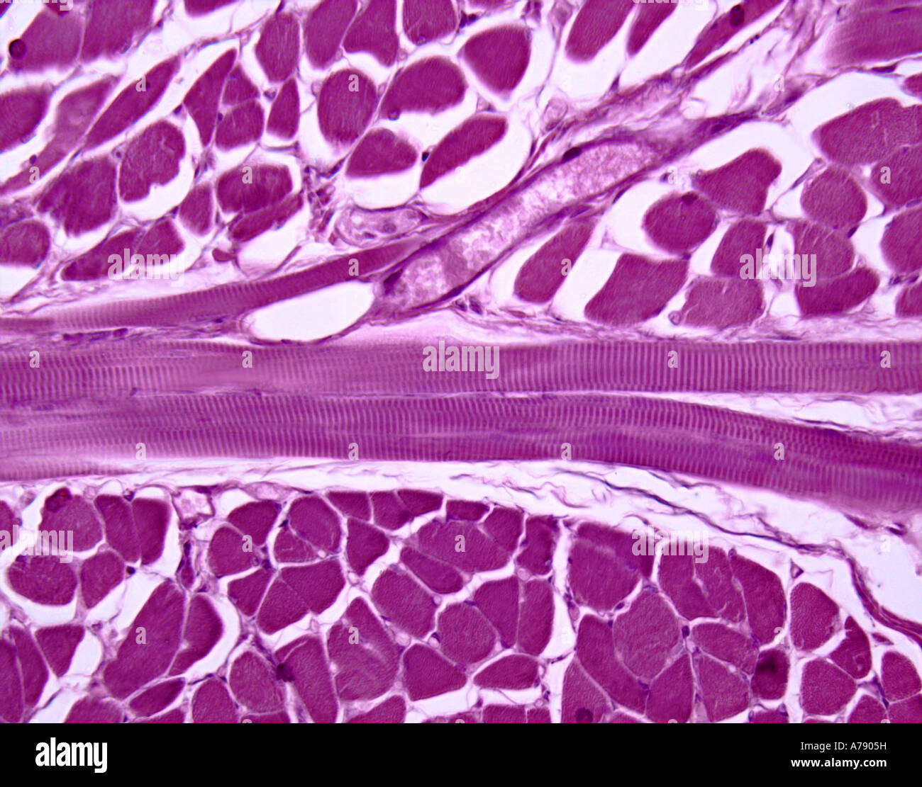 Striated muscle hi-res stock photography and images - Alamy