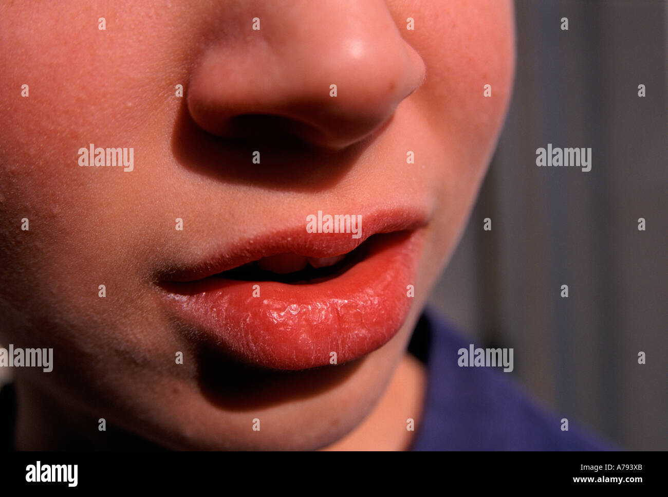 Close up of boy's nose and mouth Stock Photo - Alamy