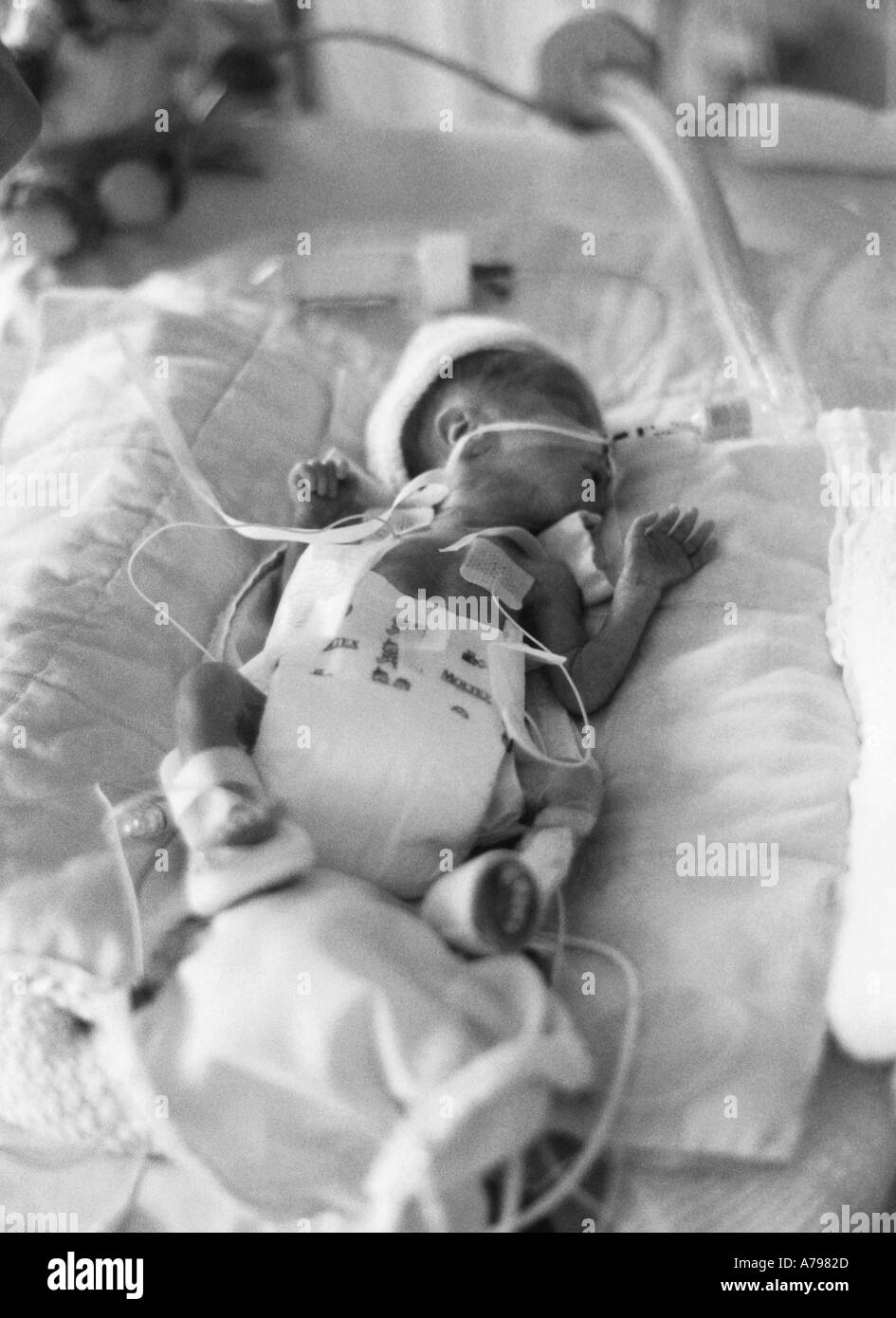 Premature Baby Black and White Stock Photos & Images - Alamy