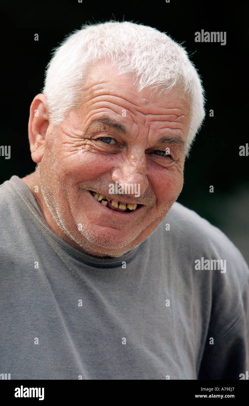 old man hoary white wrinkly wizened ageing age decayed bad teeth grey ...