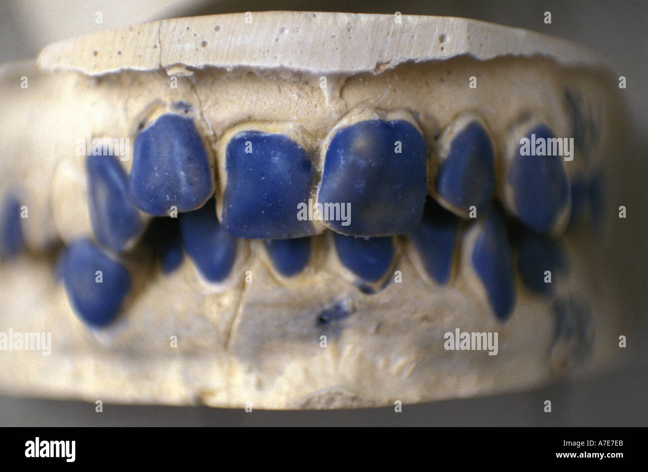 Ceramic mold of full mouth with teeth painted blue Stock Photo - Alamy