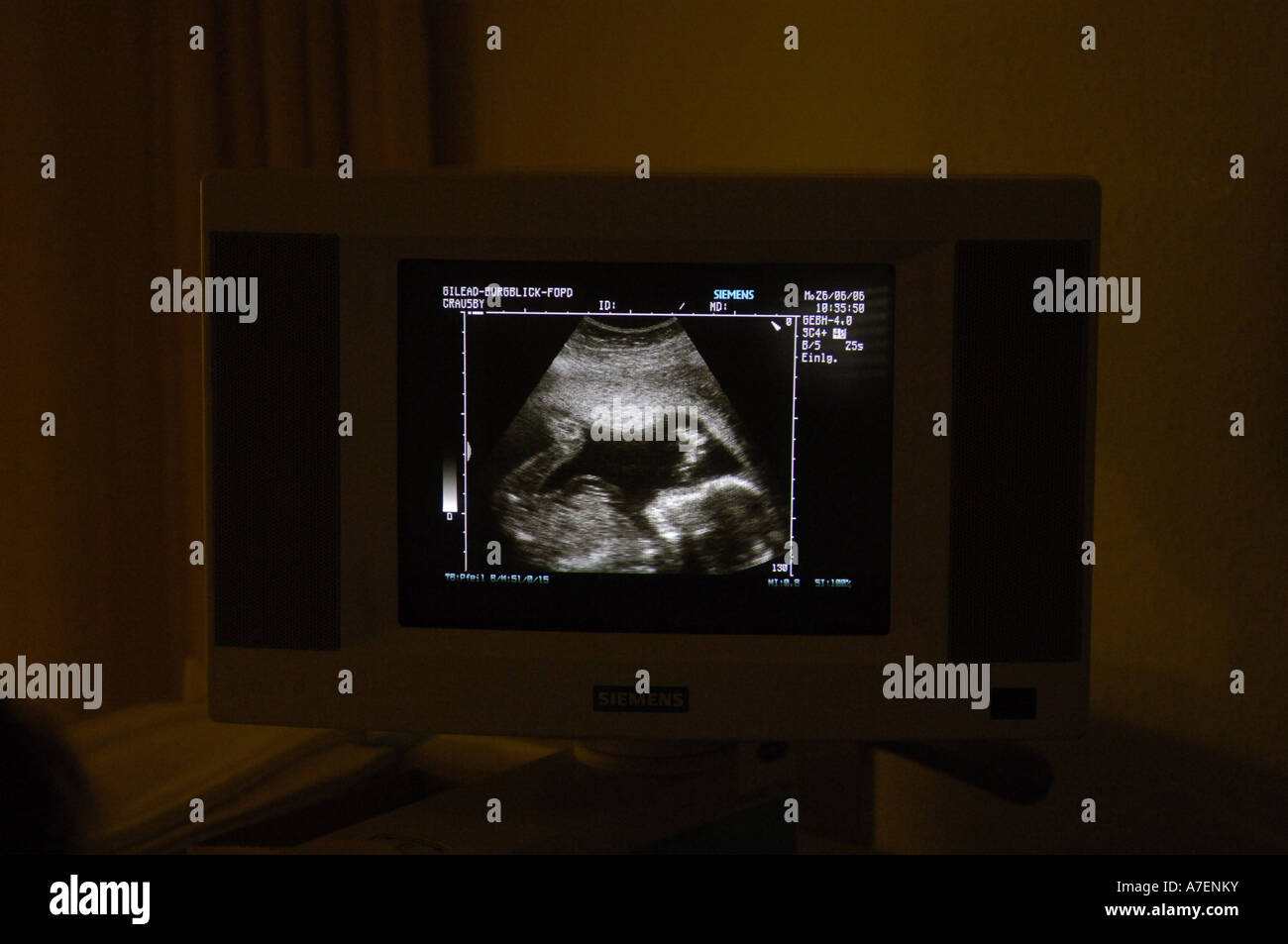 screen maternity ante natal clinic pregnancy baby scan machine computer ...